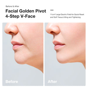 JOVS Slimax Home Microcurrent Full-body Anti-aging Device